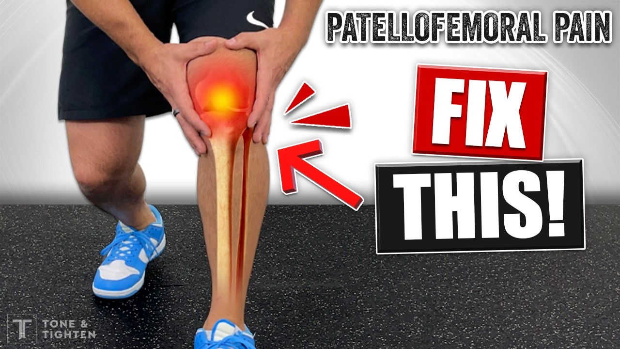 Fix Your Kneecap Pain! [Exercises For Patellofemoral Syndrome]